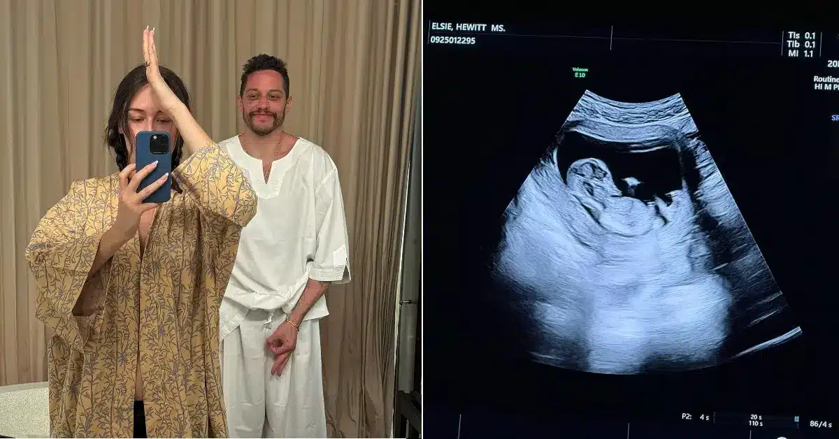 Pete Davidson and Elsie Hewitt Expecting Their First Baby